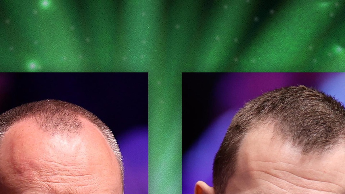 ‎Mark Williams - Mark Allen – Apple TV