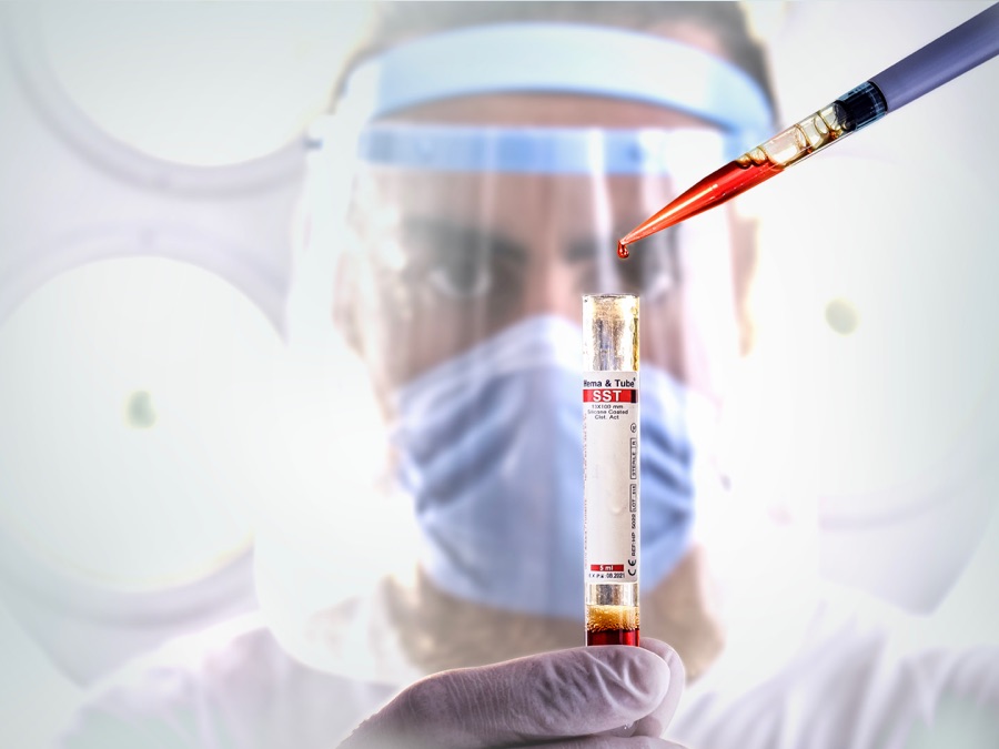 Battle For Blood - Apple TV