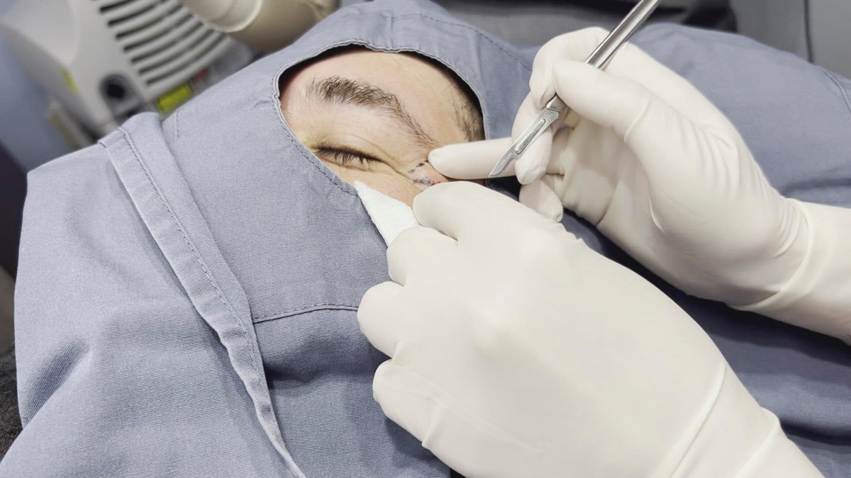 An Extra Eye - Dr. Pimple Popper: This Is Zit (Season 10, Episode 1 ...