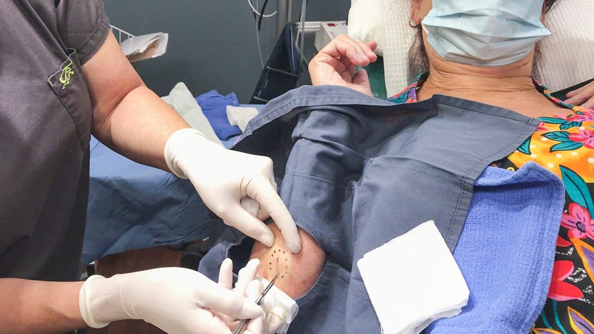 The Third Eyeball - Dr. Pimple Popper: This Is Zit (Series 7, Episode 3 ...