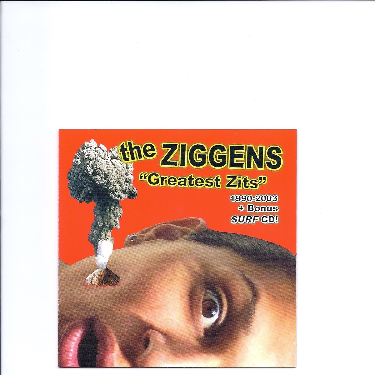 ‎Greatest Zits 1990-2003 + Bonus Surf CD - Album by The Ziggens - Apple ...