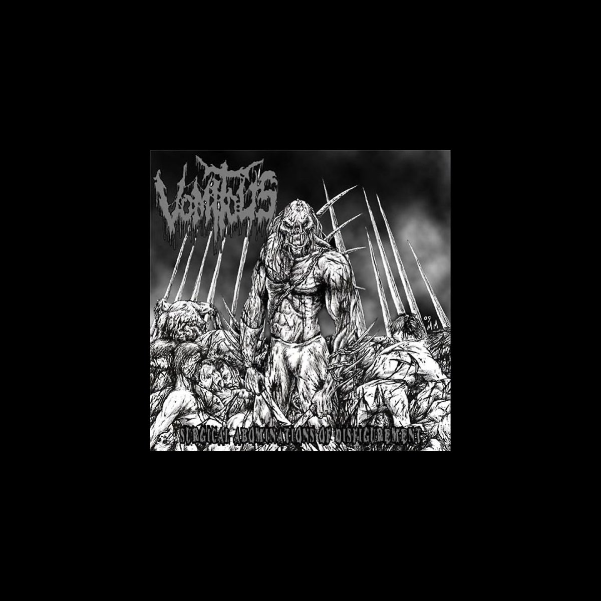 ‎Surgical Abominations of Disfigurement - Album by Vomitous - Apple Music