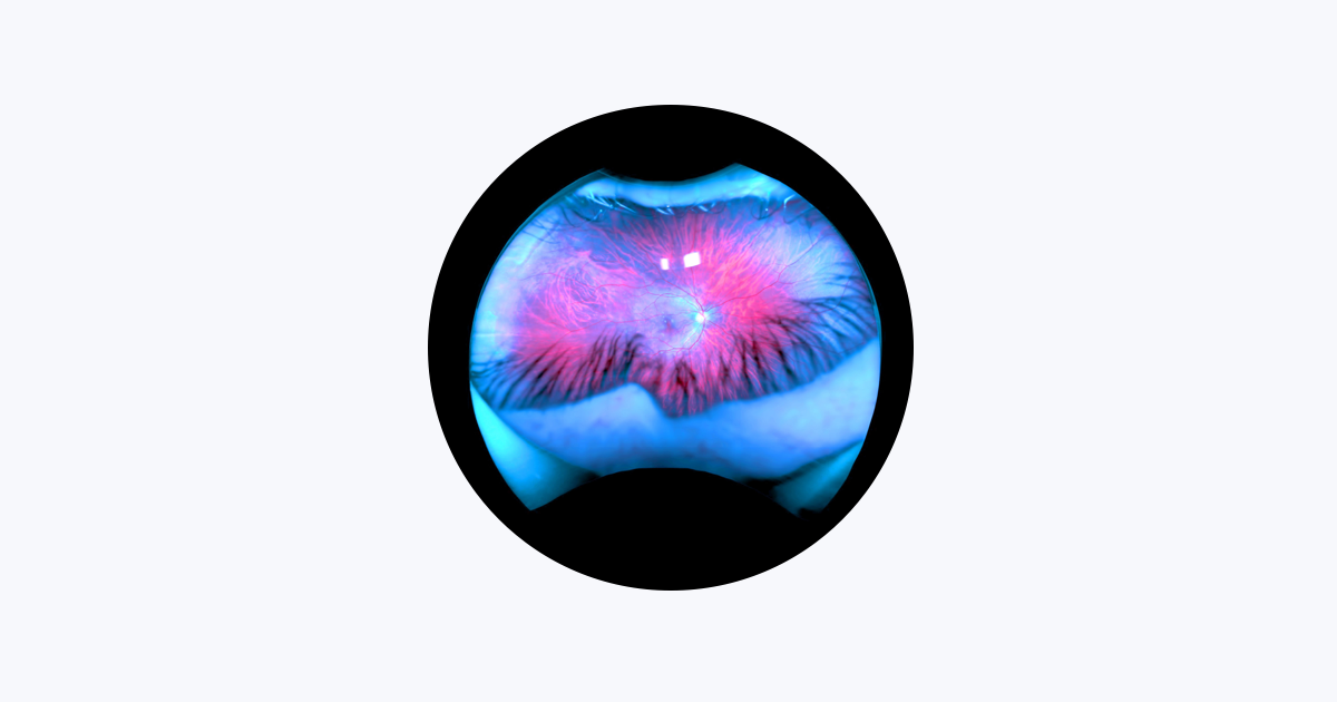bbbbb Apple Music