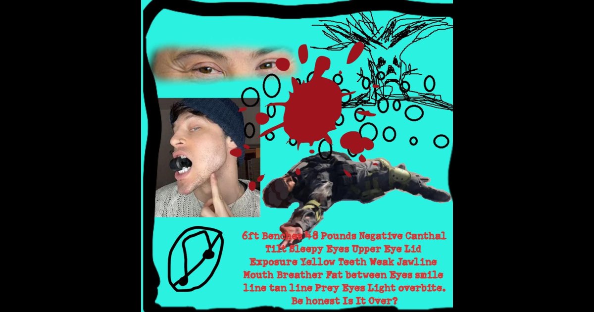 ‎Negative Canthal Tilt – Album av Chudge – Apple Music