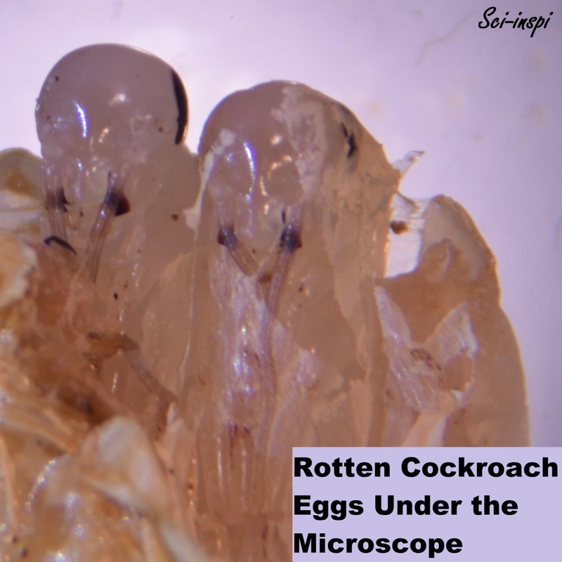Rotten Cockroach Eggs Under the Microscope - Sci-Inspi: Song Lyrics ...