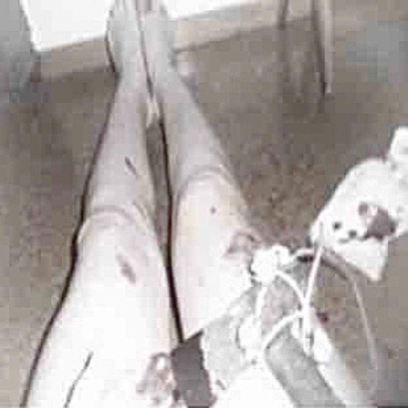 Leaking Red Glitter - KidSnorlax & cholorofilm: Song Lyrics, Music ...