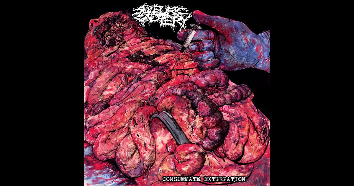 ‎CONSUMMATE EXTIRPATION - Álbum de Sulfuric Cautery - Apple Music