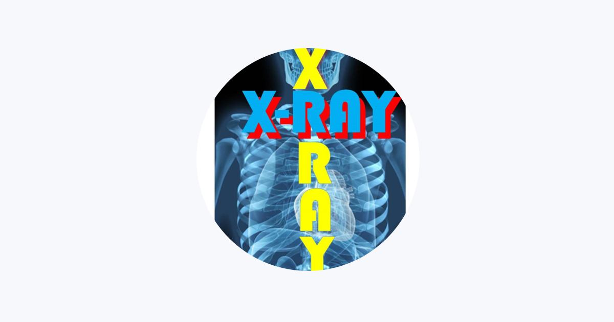‎Xray Xray - Apple Music