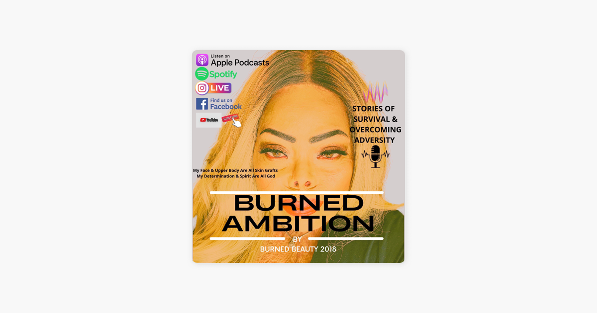 burned Ambition By Burned Beauty 2018 A Burn Survivors Podcast On