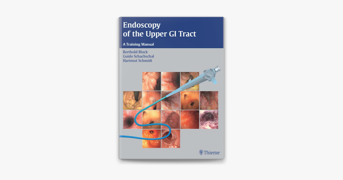 ‎Endoscopy of the Upper GI Tract de Berthold Block, Guido Schachschal ...