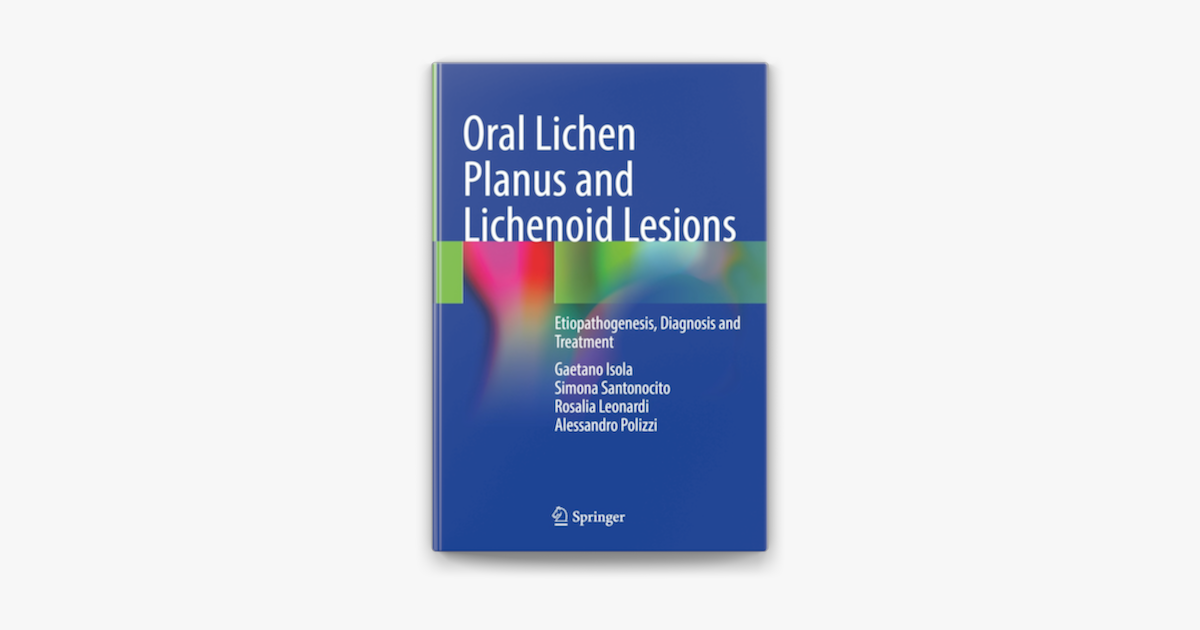 ‎Oral Lichen Planus and Lichenoid Lesions by Gaetano Isola, Simona Santonocito, Rosalia Leonardi ...