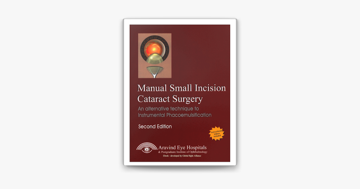 ‎Manual Small Incision Cataract Surgery by Dr. G. Natchiar on Apple Books