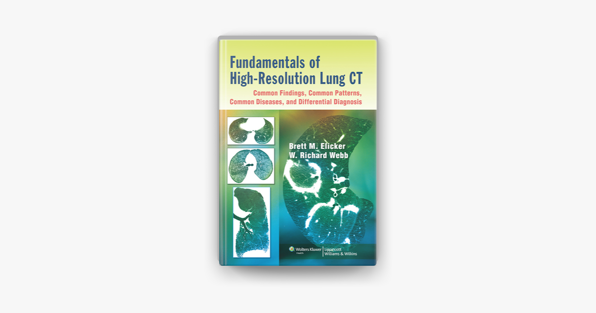 fundamentals Of High Resolution Lung Ct By Brett M Elicker And W