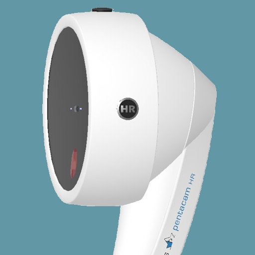 Pentacam Viewer by OCULUS Optikgeraete GmbH