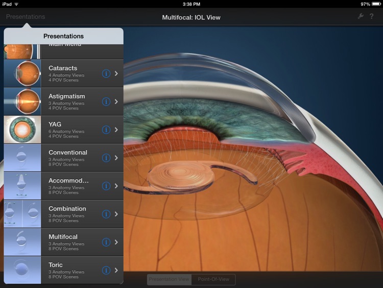 Echo IOL Simulator by Rendia, Inc.