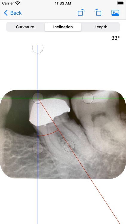 EndoPrep by Dental Sciences Australia Pty. Ltd.