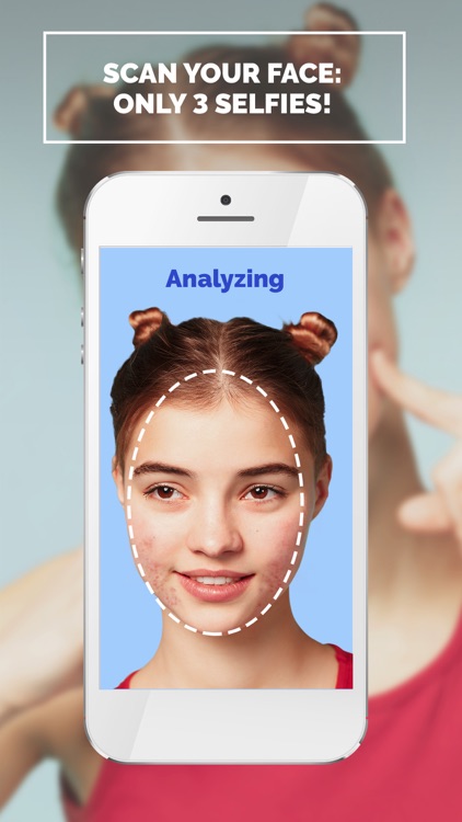 My Acnie Acne progress tracker by SkinCoach