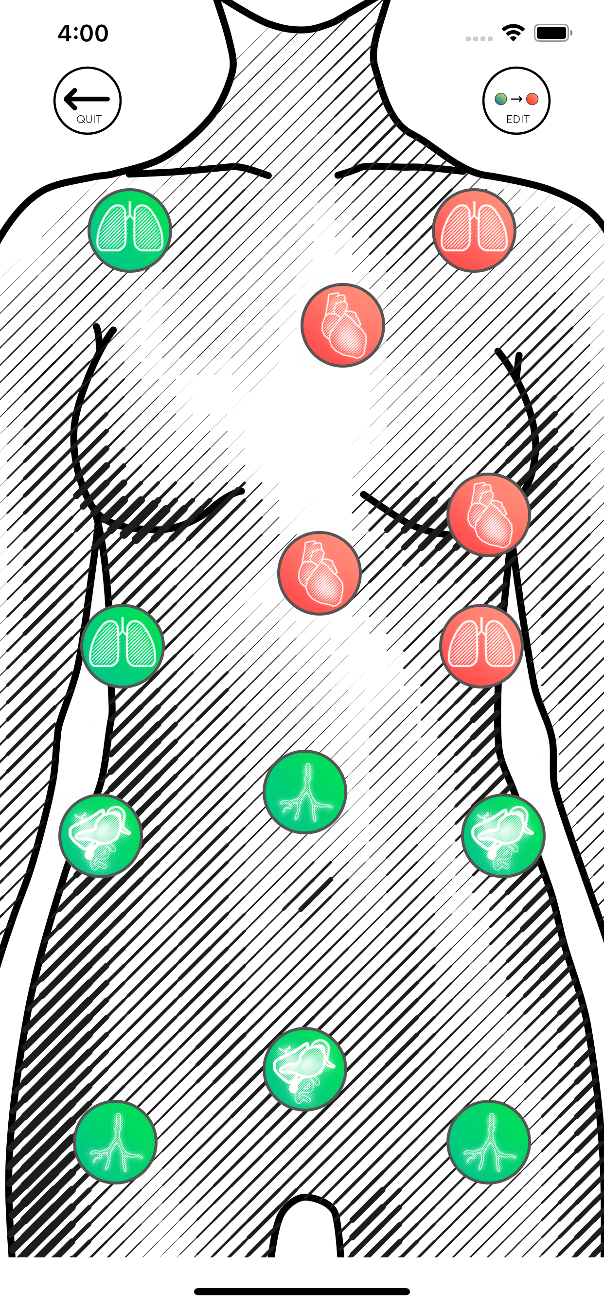 Awesome Ultrasound Simulator - Reviews, Revenue and Downloads - Apple ...