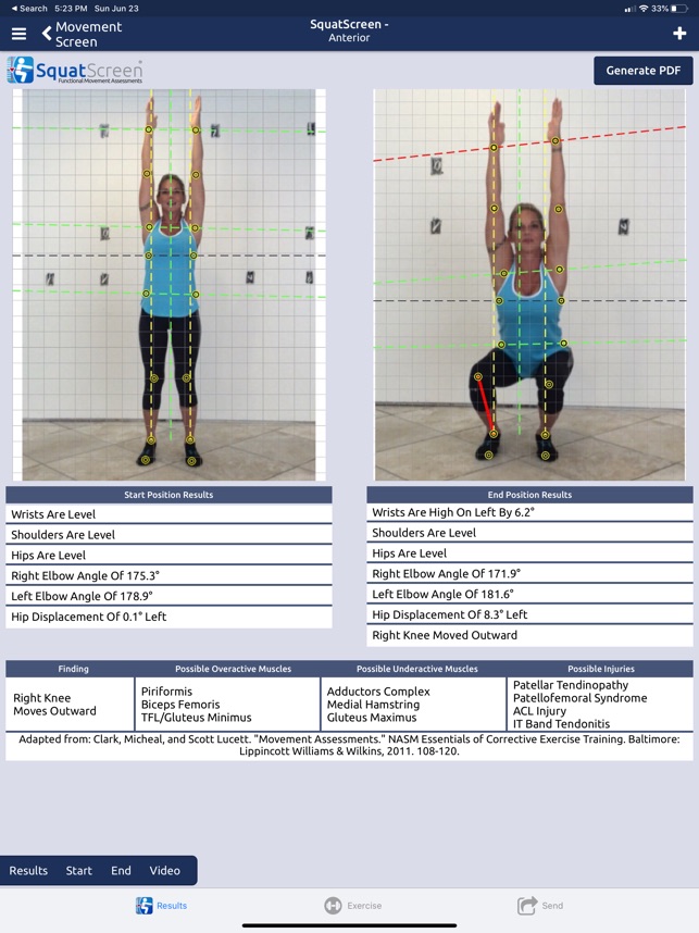 Overhead Squat Assessment Form