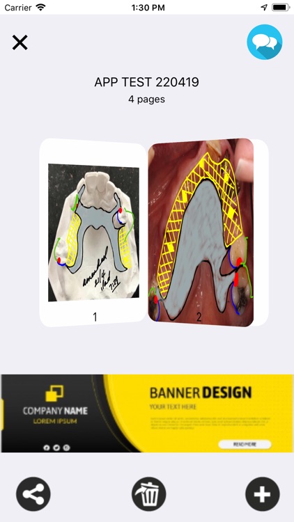 Sharpling RPD by William Sharpling