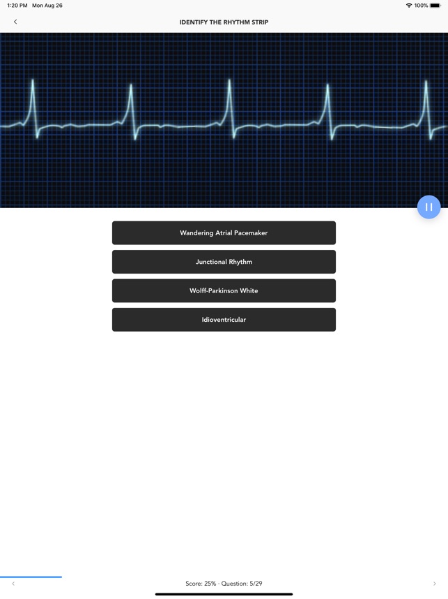 Wandering Atrial Pacemaker Rhythm Strip