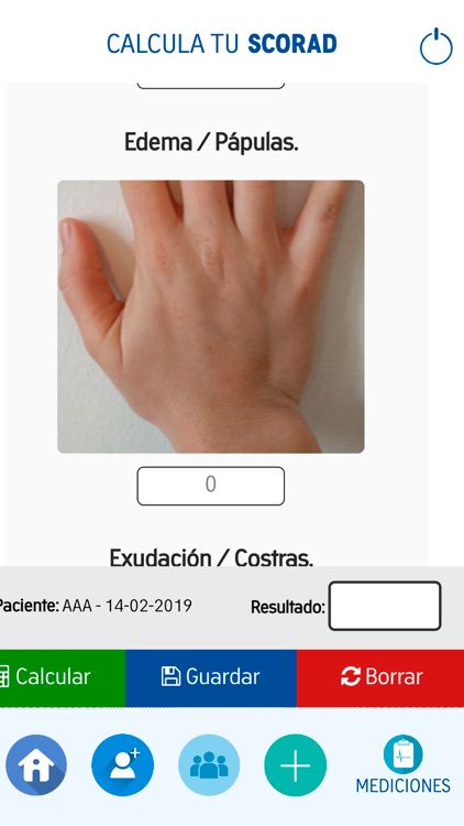 Calcula tu SCORAD by Leo Pharma España