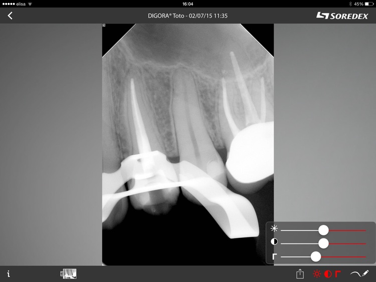 SCANORA™ Mobile by PaloDEx Group Oy