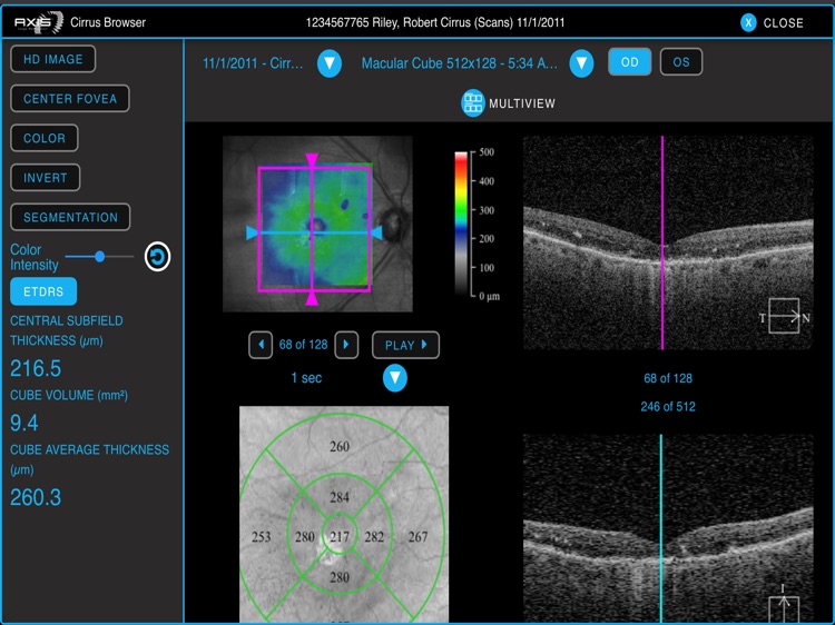 Axis Image Management by SonomedEscalon
