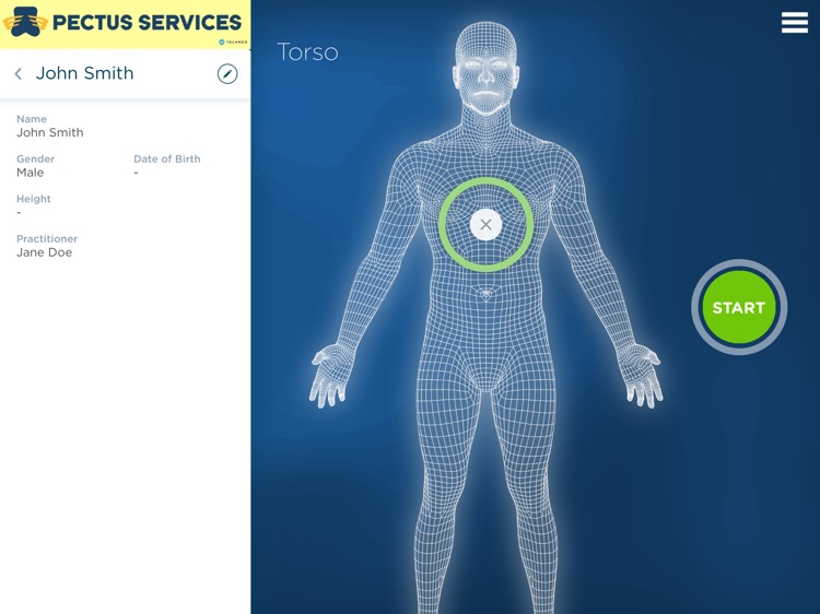 Pectus Scan by TechMed 3D