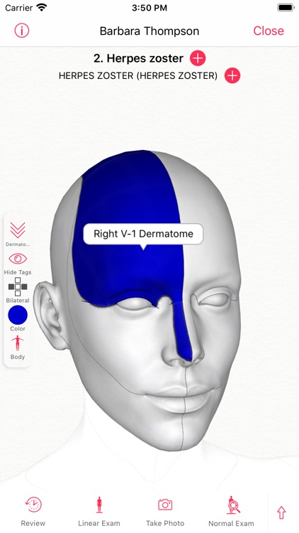 EZDERM by EZDERM, LLC
