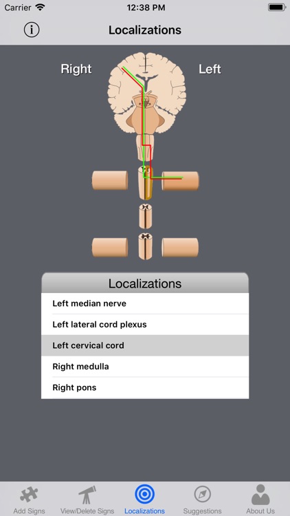 Neuro Localizer by The University of Michigan