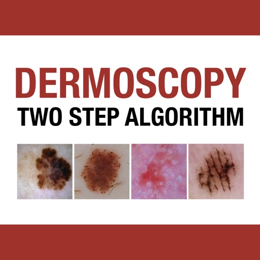 Dermoscopy Two Step Algorithm by Usatine Media LLC