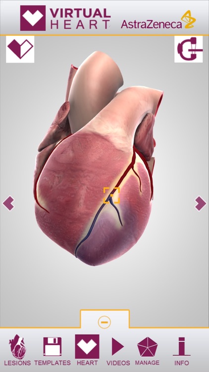 Virtual Heart - New Zealand by AstraZeneca Pharmaceuticals LP