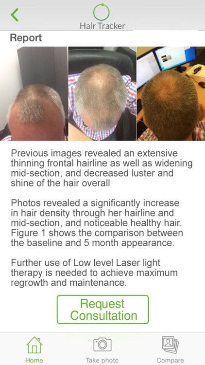 Hair Growth Tracker by Image Review Concepts Pty. Ltd.