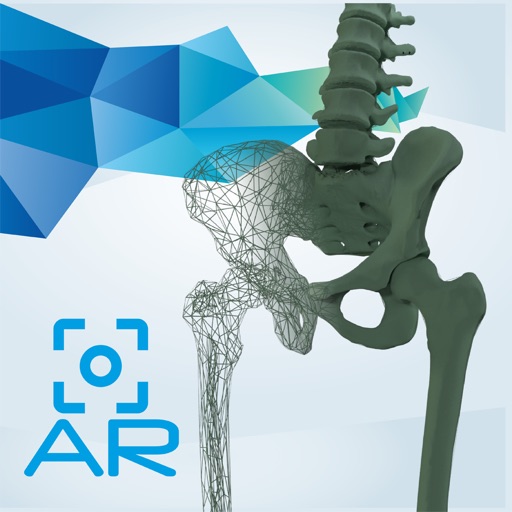 LBM AR SCHOT16 by Aribrain Dev