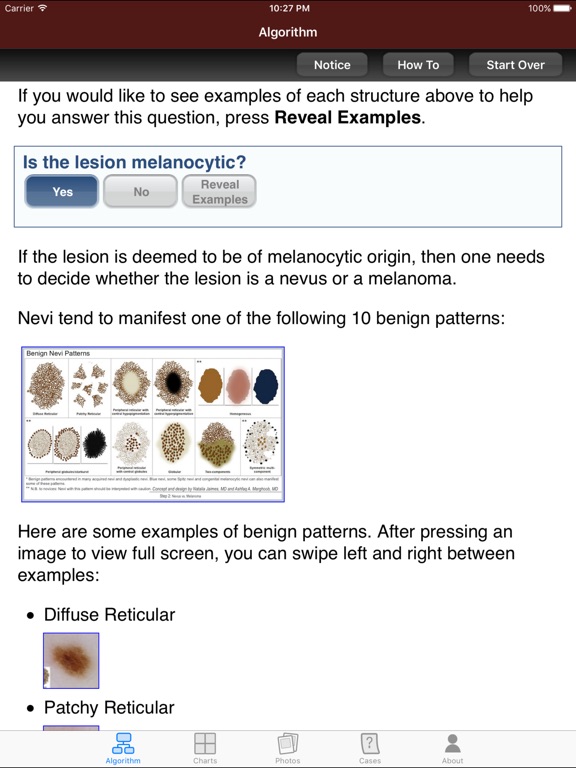 Dermoscopy Two Step Algorithm - AppRecs