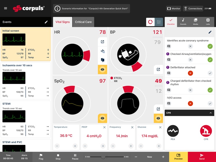 corpuls simulation by corpuls GS Elektromedizinische Geräte G. Stemple GmbH