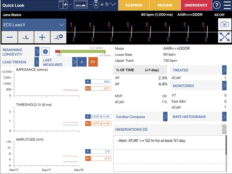 CareLink SmartSync™ RWL by Medtronic, Inc.