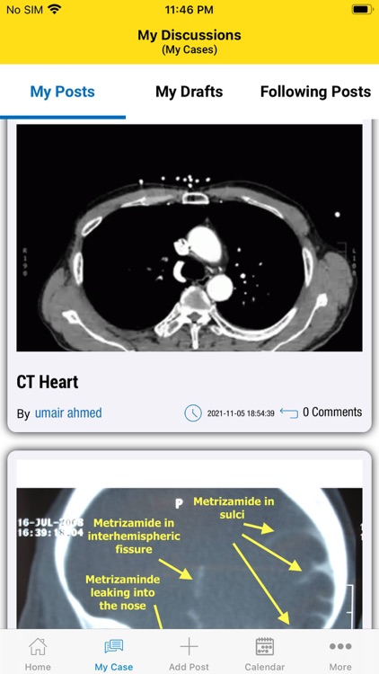 ACCESS - Cerebrovascular App by Brainspanllc ACCESS - Cerebrovascular App by Brainspanllc