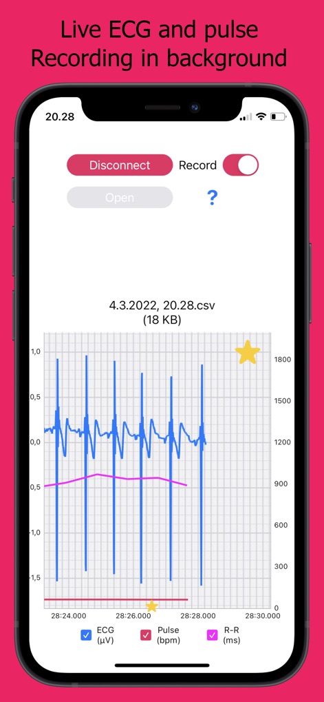 ECG Logger for Polar H10 - ヘルスケア／フィットネスアプリ | MWM