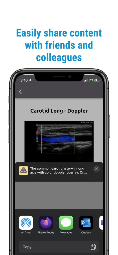 The POCUS Atlas - Education App | MWM