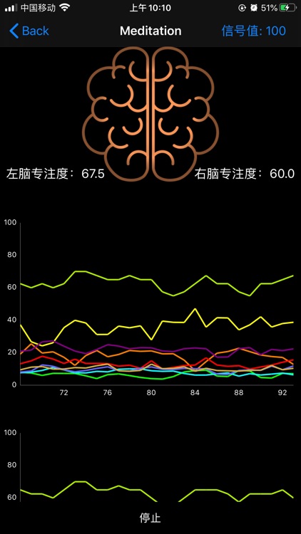 BrainLink Dual by Shenzhen Macrotellect Limited