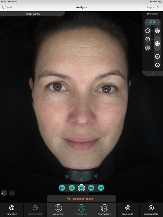 OBSERV 520x by InnoFaith beauty sciences