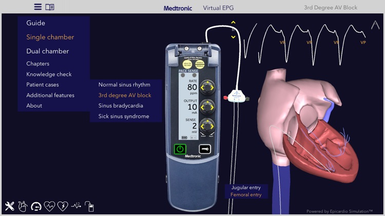 Medtronic VirtualEPG by Medtronic, Inc.
