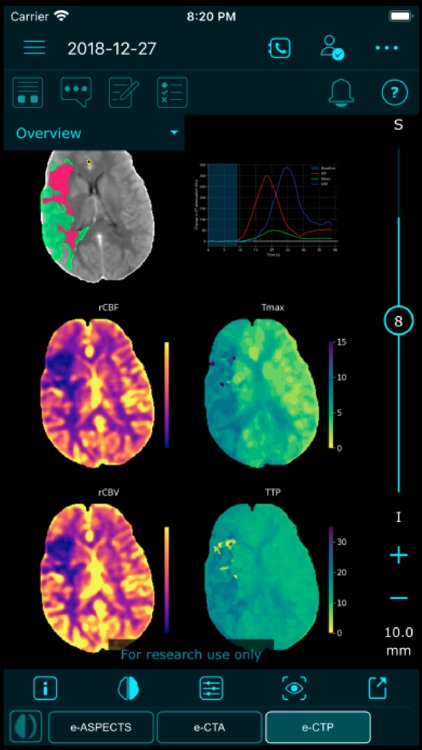Brainomix 360 Mobile by Brainomix Ltd