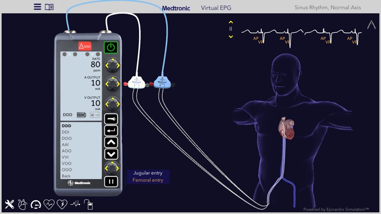 Medtronic VirtualEPG by Medtronic, Inc.