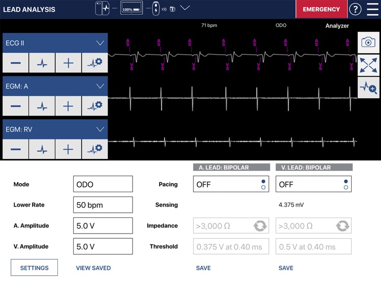 CareLink SmartSync™ RWL by Medtronic, Inc.