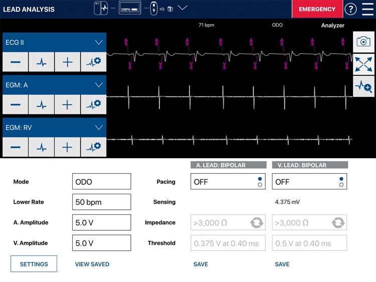 CareLink SmartSync™ CARIB by Medtronic, Inc.