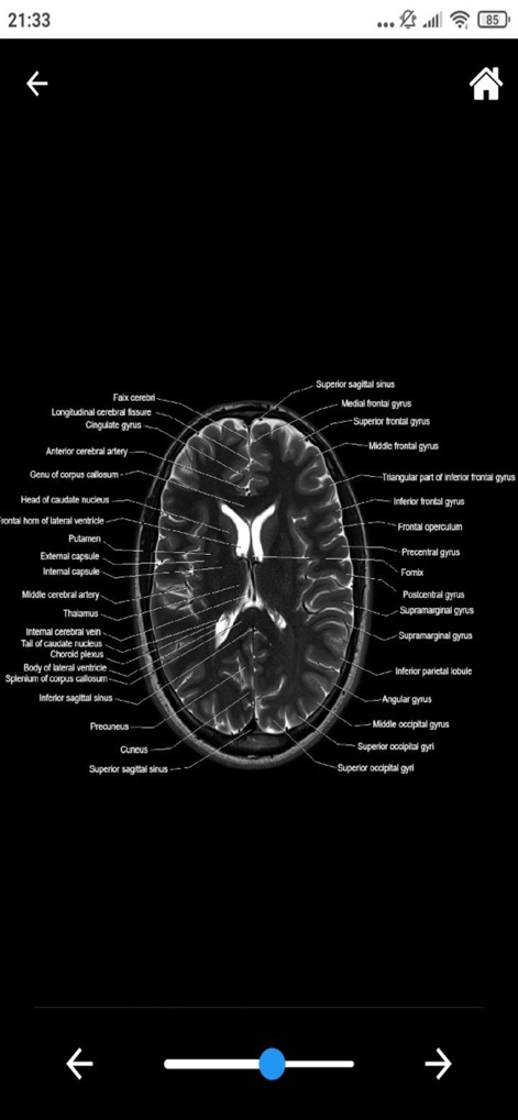 MRI MASTER - Education App | MWM