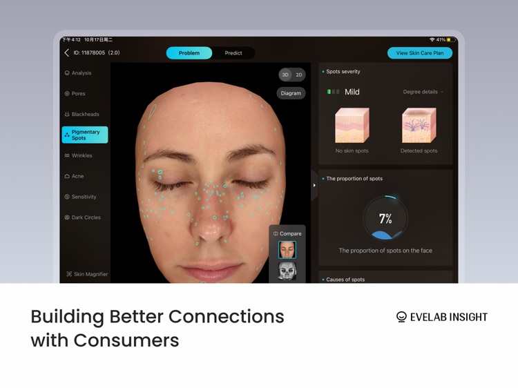 EveLab Insight Eve M by MeituEve International Limited